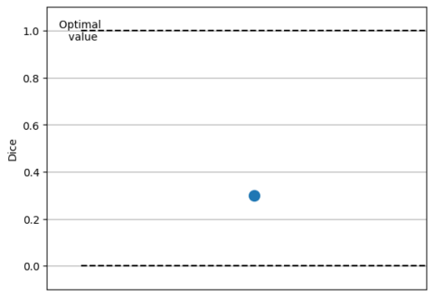 How to Calculate Dice Loss in PyTorch? | Liberian Geek